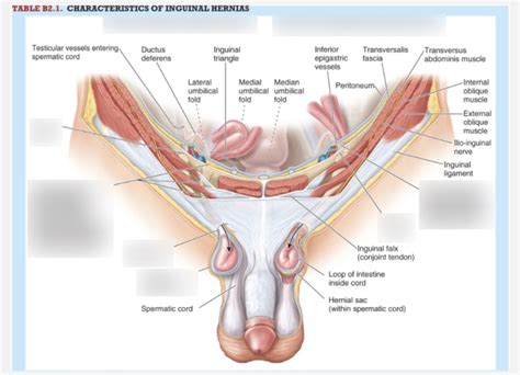 Indirect Vs Direct Inguinal Hernia