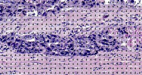 Digitized Histological Representation Of The Results Of Frame