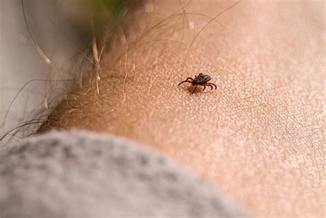 Jak wyciągnąć kleszcza Sprawdzone sposoby i porady Home