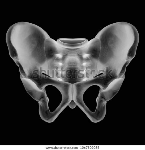 Anterior View Human Pelvis Bone Healthcare Stock Photo Edit Now