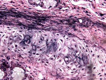 Solved Identify The Following Type Of Connective Tissue Chegg