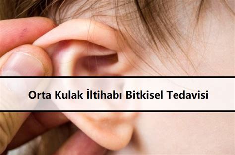 Orta Kulak İltihabı Bitkisel Tedavisi Bitkisel Tedavi