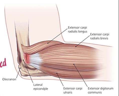 Msk Forearm Wrist Hand Flashcards Quizlet