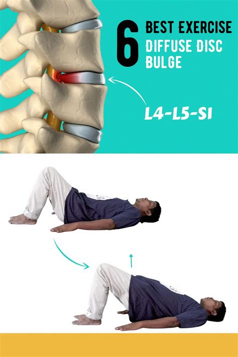 Middle Back Pain Exercises Bulging Disc Back Pain Exercises Bulging