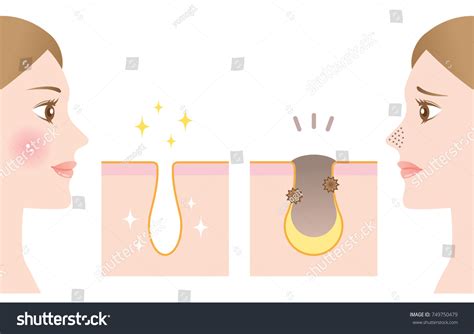 Skin Impurities Over 37 Royalty Free Licensable Stock Vectors Vector