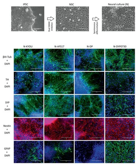 A Differentiation Of Ipscs Into Neurons Through The Neural Stem Cell