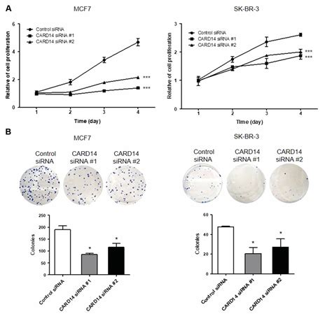 Knockdown Of CARD14 Inhibits Cell Proliferation And Migration In Breast