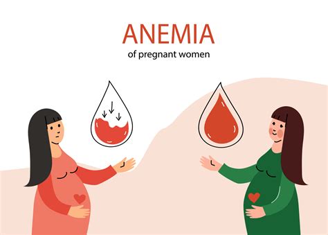 Concepto De Anemia Mujer Embarazada Que Sufre De Anemia Bajo