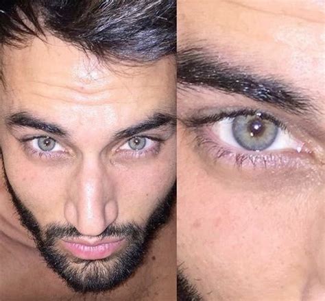Images Of Before And After The Treatment Of Eye Color Change Eyecos