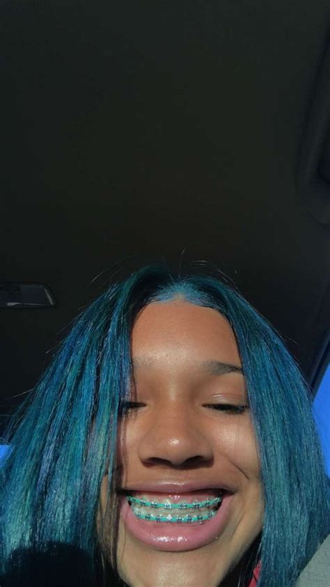 Pin On Braceface Braces Colors Cute Braces Braces Girls