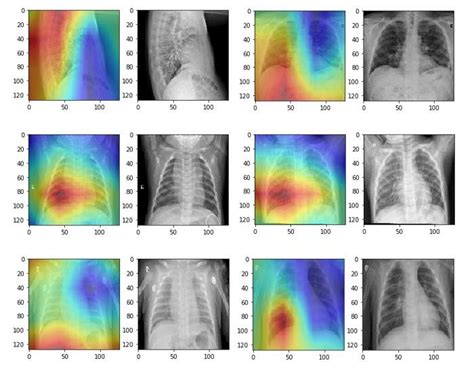 examples of class activation maps for the four convolutional neural vrogue