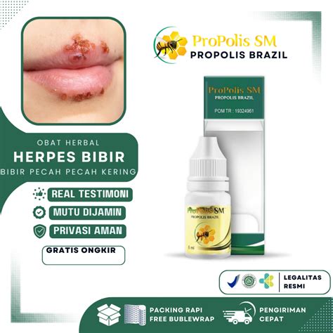 Jual Obat Herpes Bibir Obat Herpes Zosper Obat Bintik Bintik Di Bibir