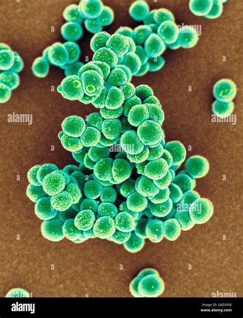 Mrsa Bakterien Farbige Scanning Electron Micrograph Sem Methicillin