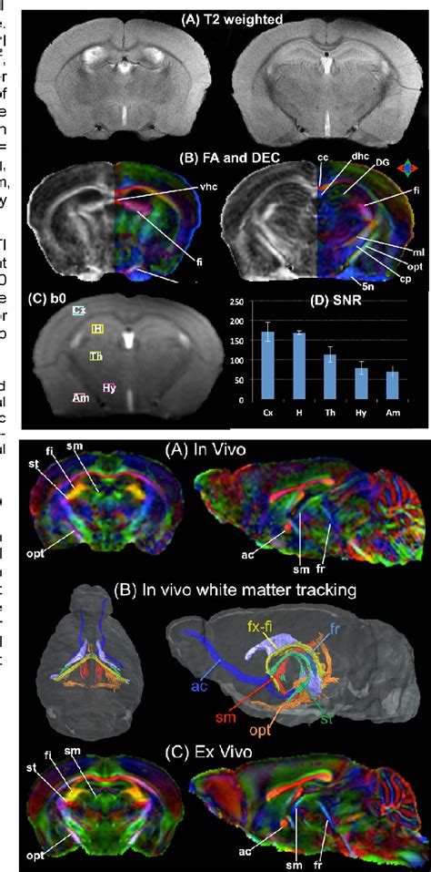 figure 1 from in vivo high resolution diffusion tensor imaging of the mouse brain semantic scholar