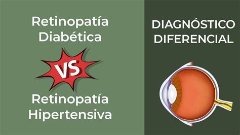 Diagnóstico Diferencial Retinopatía Diabética vs Retinopatía