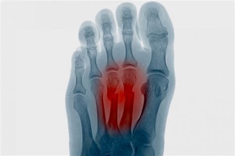 Radiologie Du Pied Clinique Et Centre De Chirurgie Podiatrique