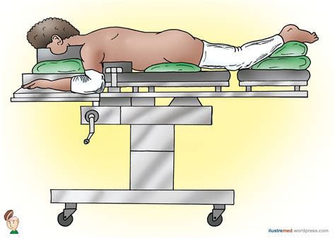 Cirurgia Minimamente Invasiva Da Coluna Cirurgia Da Coluna