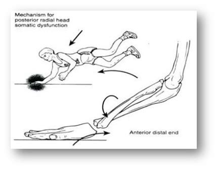 Lecture Elbow Wrist And Hand Flashcards Quizlet