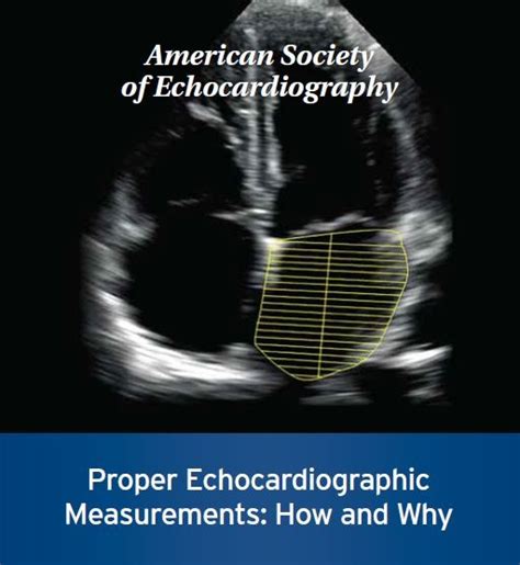 Lv Mass Measurement 2d Echo Semashow