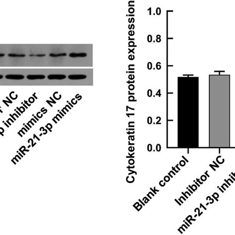 MiR 213p Regulates The Protein Expression Of Cytokeratin 17 Western