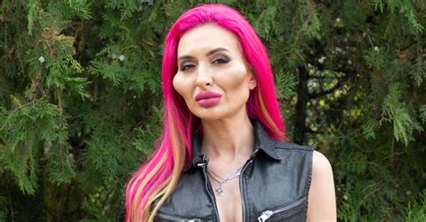 Model With World S Biggest Cheeks Shows The Way She Looked Before