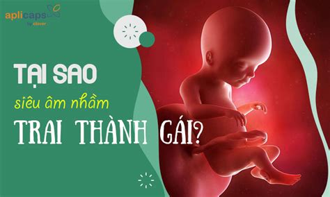Top 15 tại sao siêu âm nhầm trai thành gái mới nhất năm 2023 EU