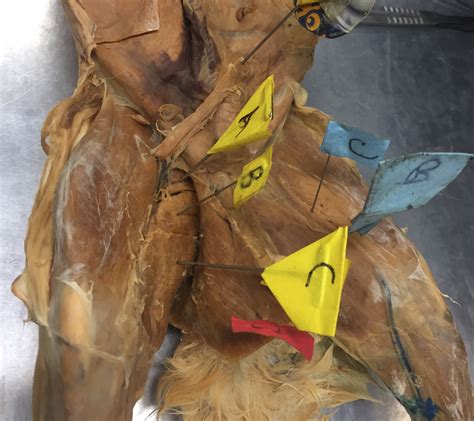 Deep Muscle Of The Hind Limb Of The Cat In Medial View Diagram Quizlet