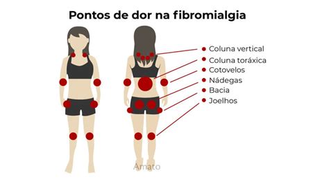 Causas De Dor Abdominal Dor Na Barriga Vascular Pro