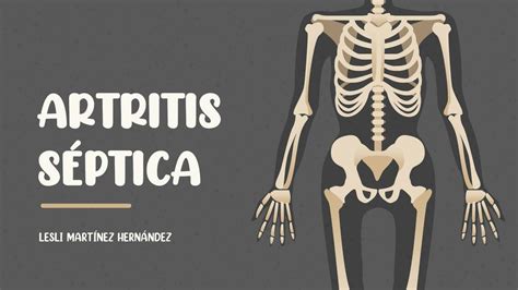 Artritis S Ptica Lesli Mart Nez Udocz