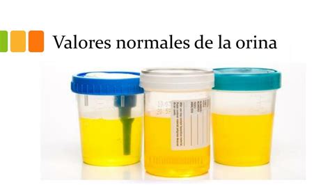 Valores Normales De La Orina Angel Povea Marin UDocz