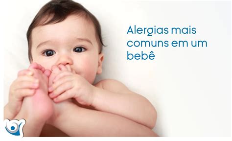 Alergias mais comuns em um bebê Alergoclínica