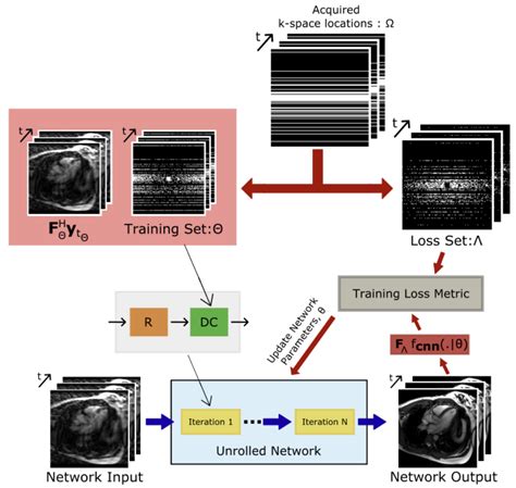 bioengineering free full text deep learning based reconstruction for cardiac mri a review
