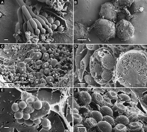 Sexual And Asexual Structures Of Penicillium Roqueforti Taken Using