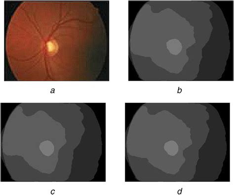 localisation and segmentation of optic disc with the fractional‐order darwinian particle swarm