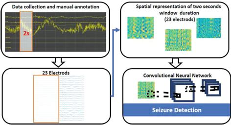 pdf epileptic seizure detection using a convolutional neural network 2019 bassem bouaziz