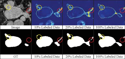 figure 1 from mutual consistency learning for semi supervised medical image segmentation