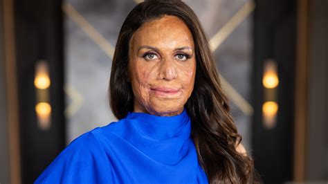 Turia Pitt Celebrity Apprentice Australia Cast Official Bio
