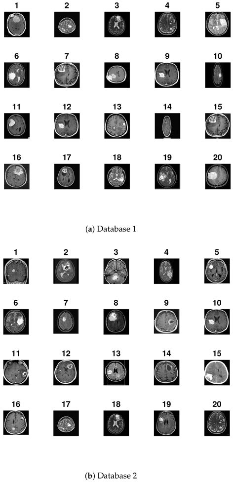 bdcc free full text automatic human brain tumor detection in mri image using template based