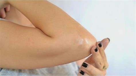 5 Bahan Alami Untuk Mencerahkan Siku Dan Lutut Fashion Beauty