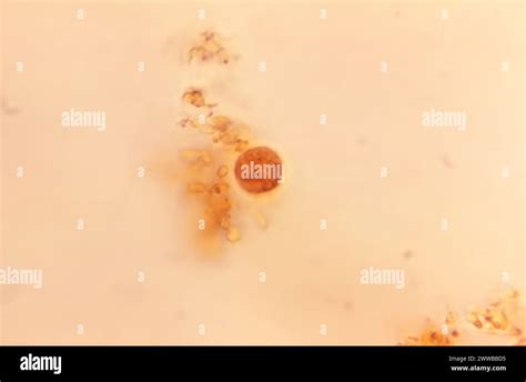 Under 1187 5X Magnification This Photomicrograph Of A Trichrome