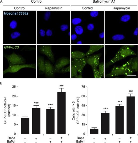 High Throughput Quantification Of GFP LC3 Dots GFP LC3 Expressing