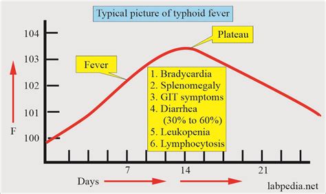 Typhoid Fever Enteric Fever Salmonella Typhi