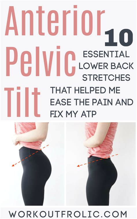 7 Anterior Pelvic Tilt Exercises To Fix Painful Lower Back Artofit
