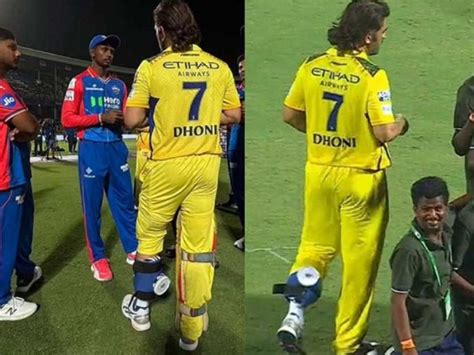 CSK Coach Eric Simmons Gives Major Update On MS Dhoni S Injury After