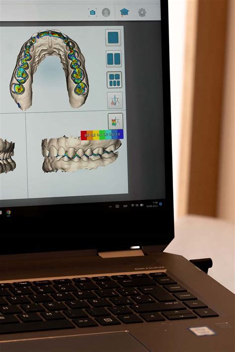 Diseño Digital de Sonrisas Clínica Dental Arias López