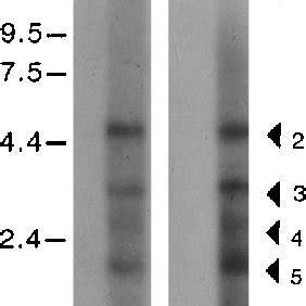 Northern Blot Hybridization Analyses Of Total Cytoplasmic Rna From