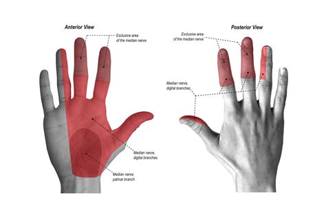 Median Nerve Neurologyneeds