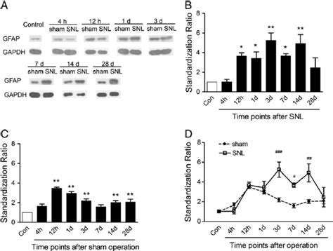 Western Blot Analysis Of GFAP Protein Expression In L5 DRG Following