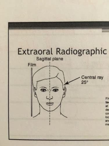 Radiography Final Flashcards Quizlet