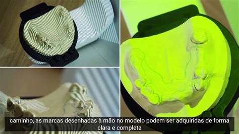 Dental Ita Scanner Odontológico 3D SHINING 3D Digital Dental